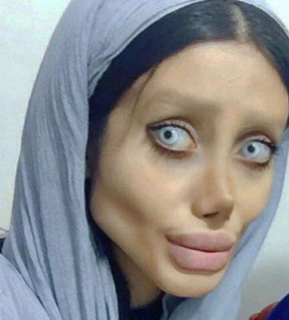 Before 50 plastic surgeries, the girl with the face “like” Angelina ...